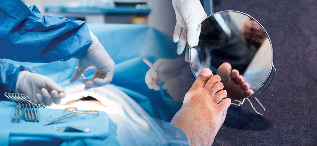 Diabetic Foot Care: Surgical Interventions for Managing Infections
