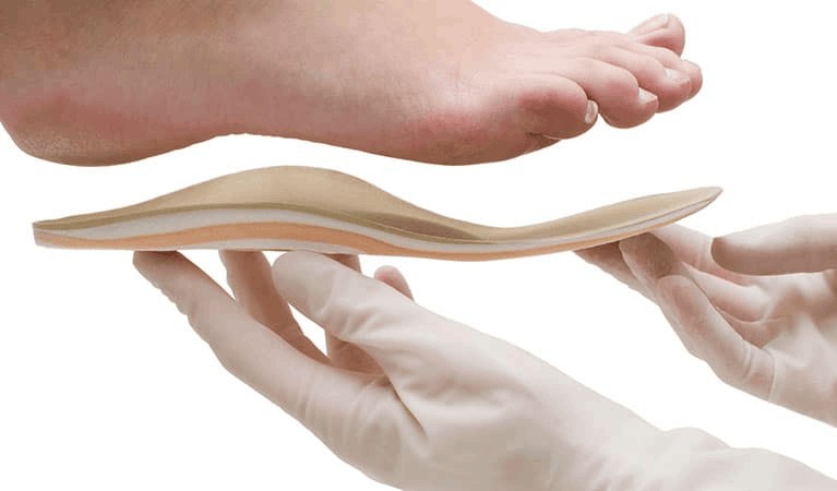 Effective Treatments for High Arch Feet | DiabeticShoe.in