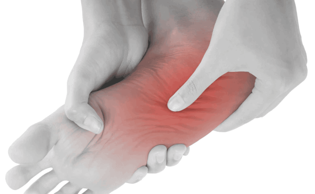 Discover the Top 4 Treatments for Arch Pain Relief