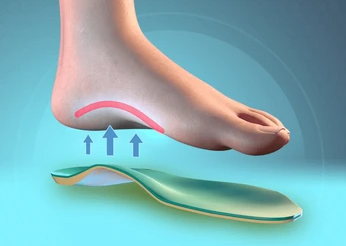 Benefits of Proper Arch Support for Feet | DiabeticShoe.in