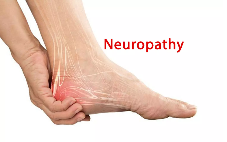 Neuropathy Images: Diagnostic Insight & Relief