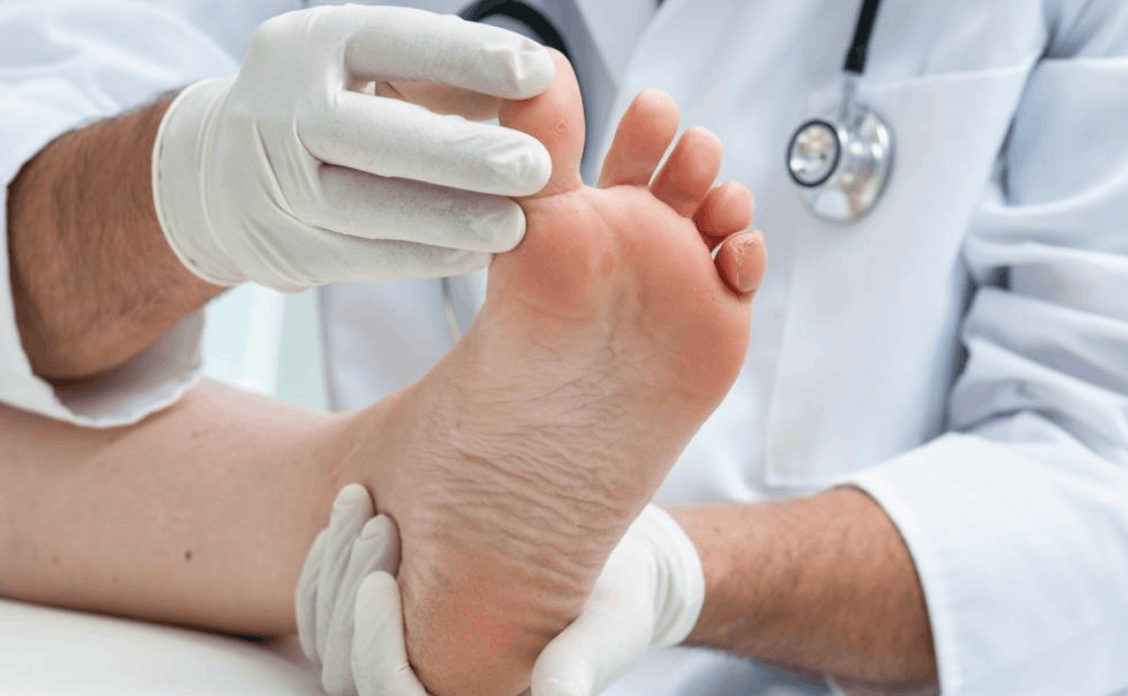 HOW TO SPOT THE SIGNS OF POOR FOOT HEALTH BEFORE IT BECOMES A PROBLEM