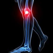 Improve Poor Blood Circulation in Legs Naturally