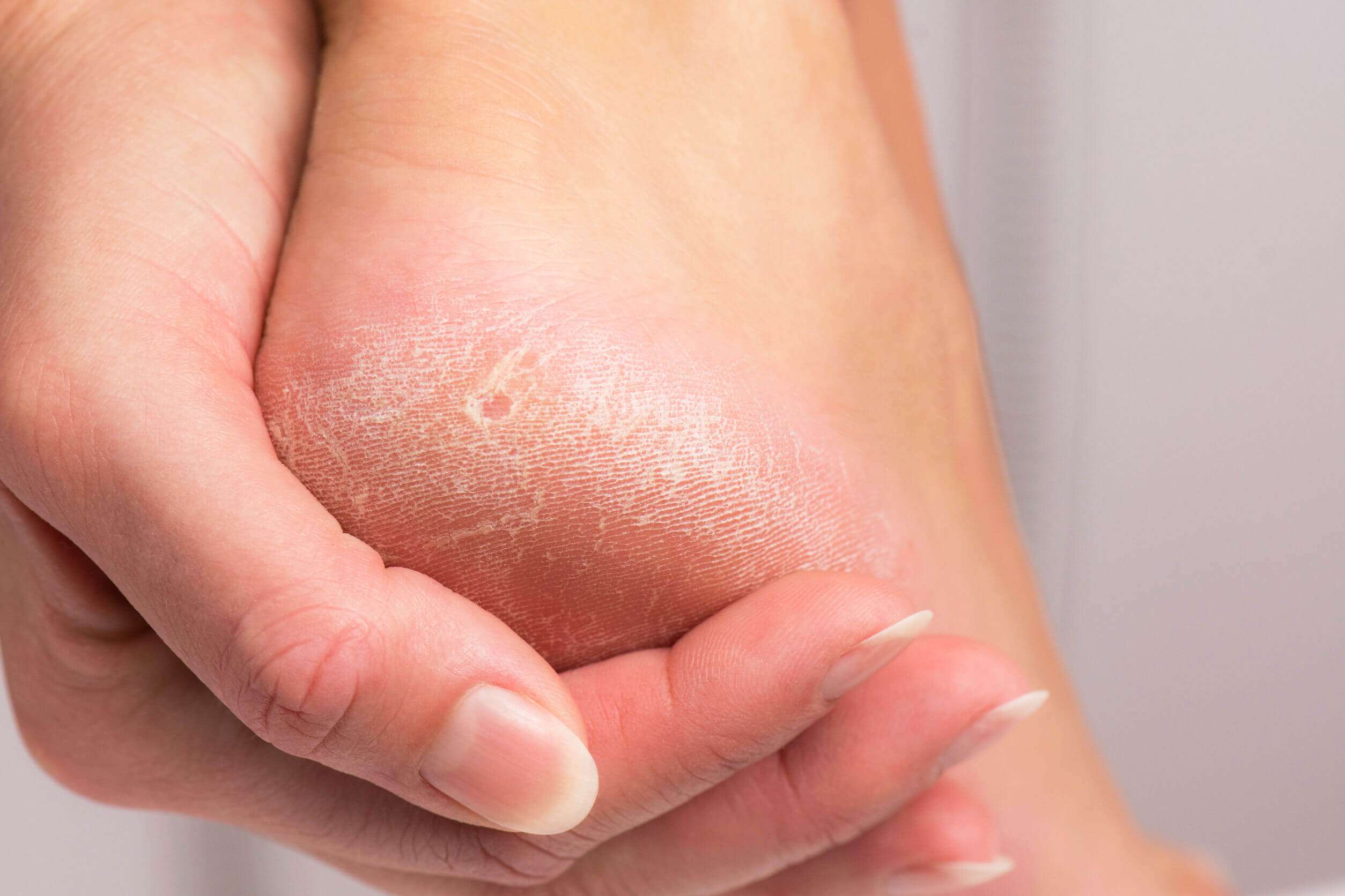 Is Heel Pain a Sign of Cancer? Causes & Relief Explained | DiabeticShoe.in