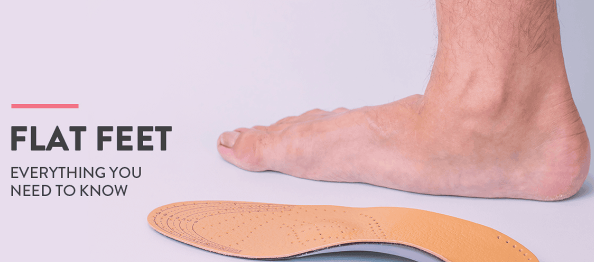 Understanding Flat Foot: Causes, Symptoms, and Treatment | Health